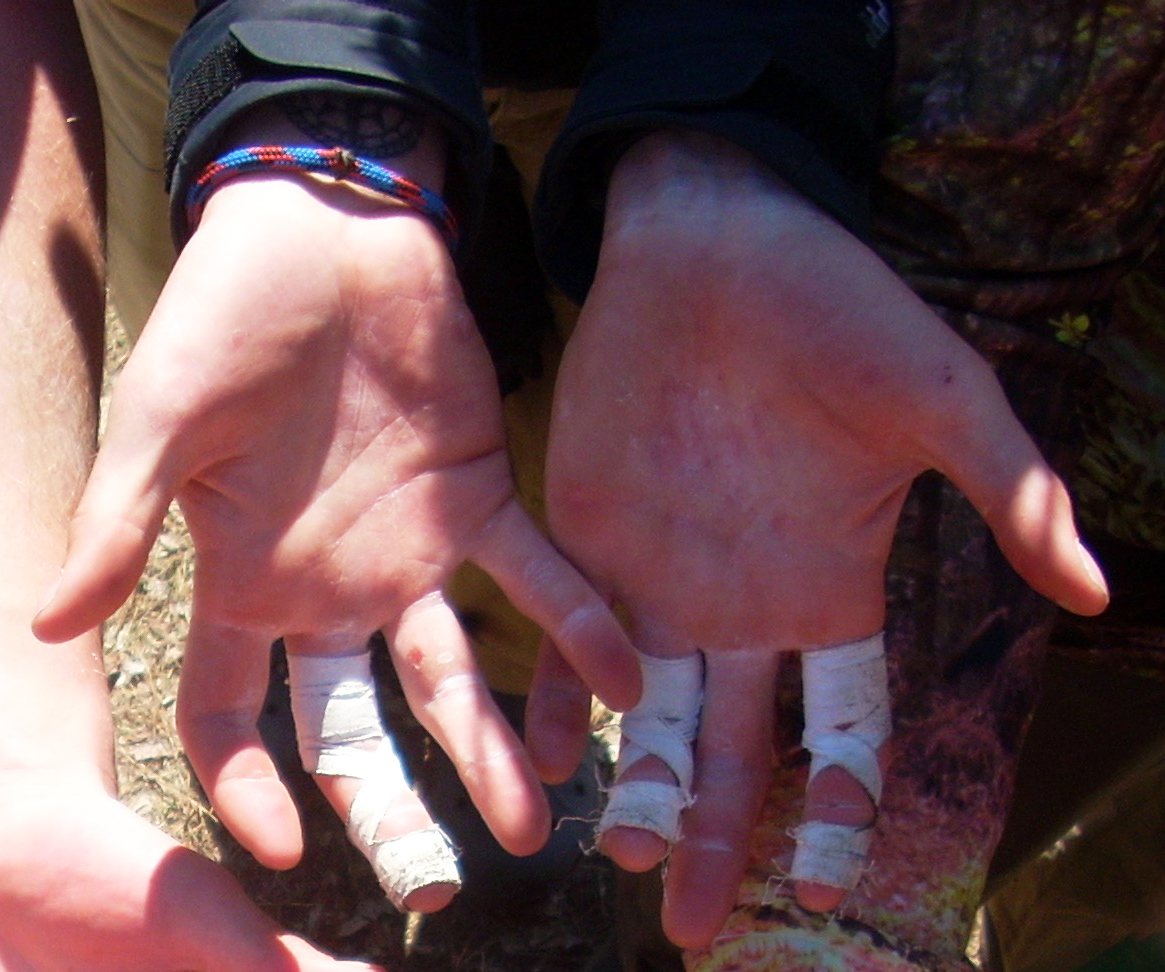 Climbers and Their Hands – Coffee. Tape. Climb.